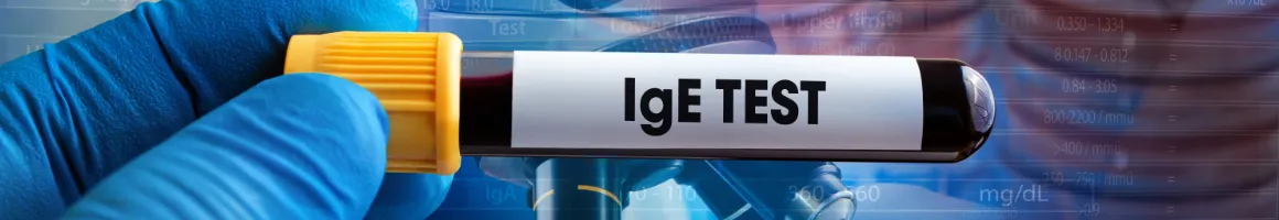 ALEX2 – Comprehensive Allergy Test | YEHS